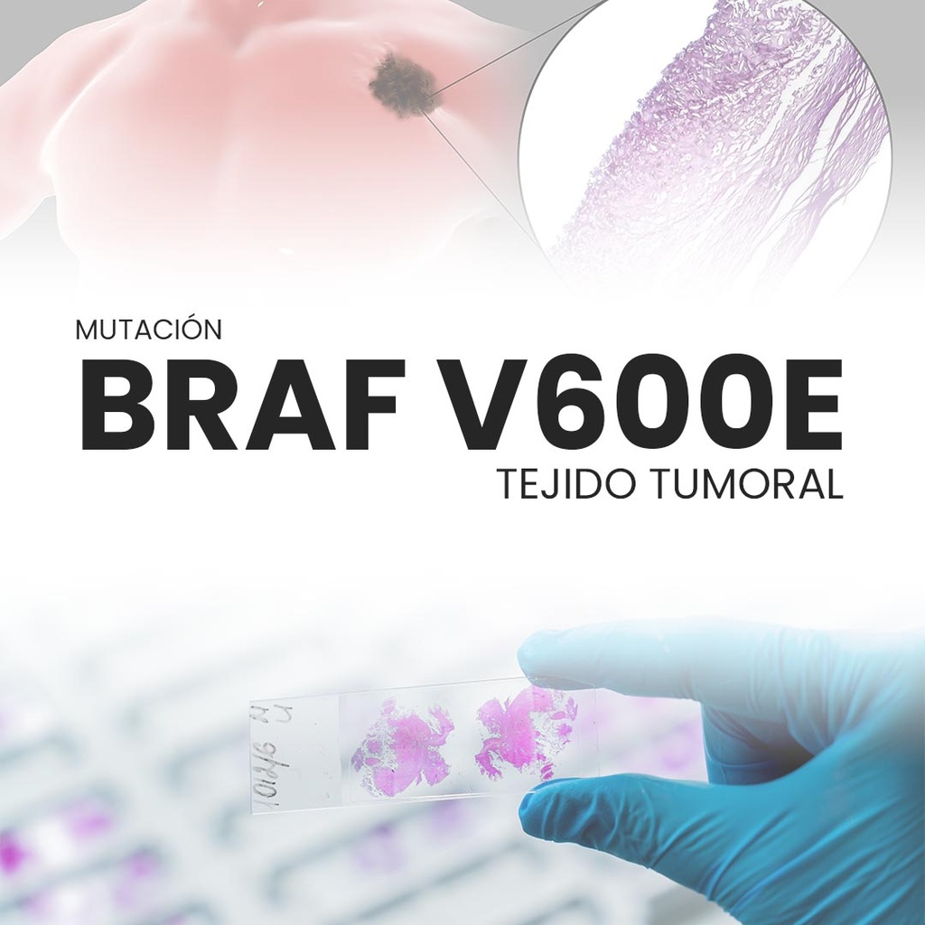 Mutación BRAF V600E (Tejido tumoral) | Nanopharmacia Diagnostica